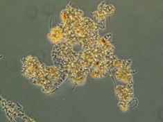 What are those "bugs" in the activated sludge?!